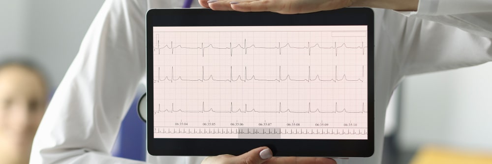 What is Heart Rate Variability (HRV) & How to Monitor? | MyFitnessCoach
